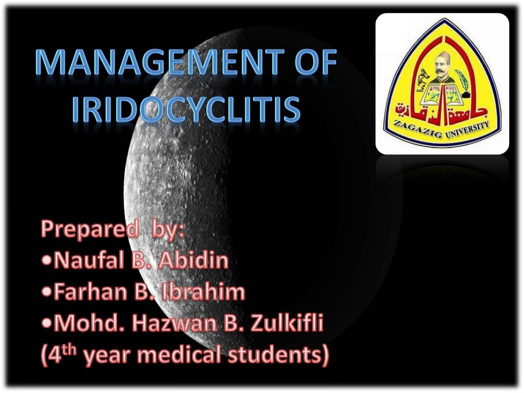 PPT - Management of iridocyclitis PowerPoint Presentation, free ...