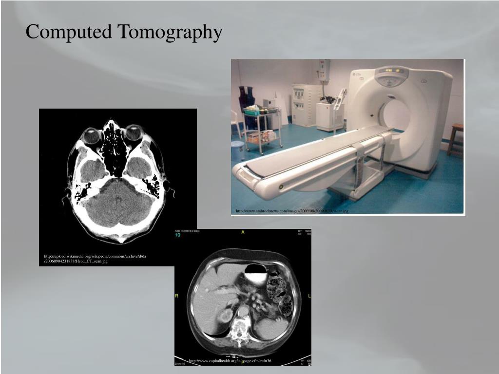 PPT - Computed Tomography PowerPoint Presentation, free download - ID ...