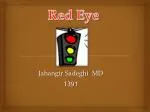 PPT - RED EYE PowerPoint Presentation, free download - ID:4462254