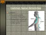 PPT - POSTURE N POSTURAL DEFORMITIES PowerPoint Presentation, free ...