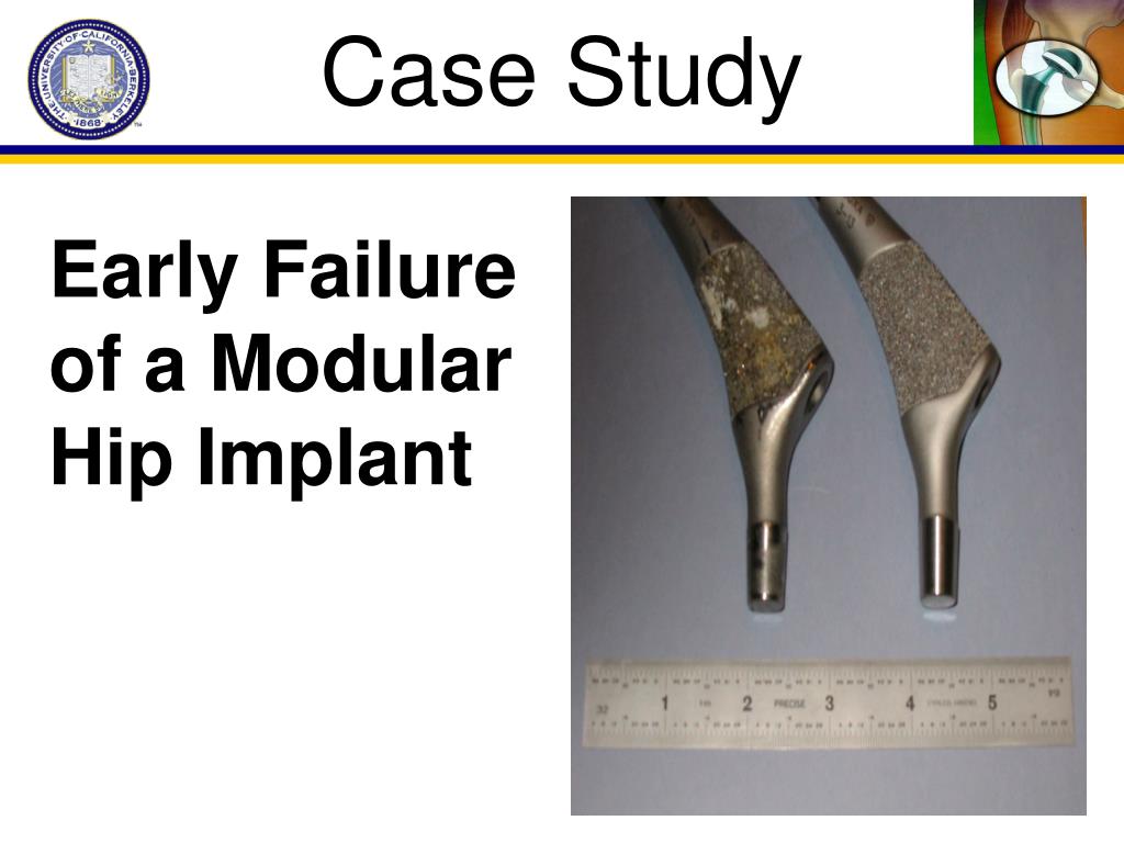 PPT - Early Failure of a Modular Hip Implant PowerPoint Presentation ...