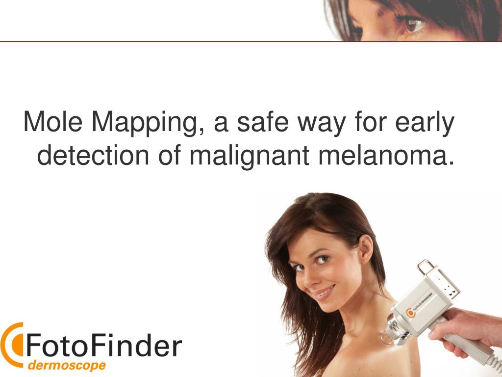 PPT - Mole Mapping… PowerPoint Presentation, free download - ID:1779396