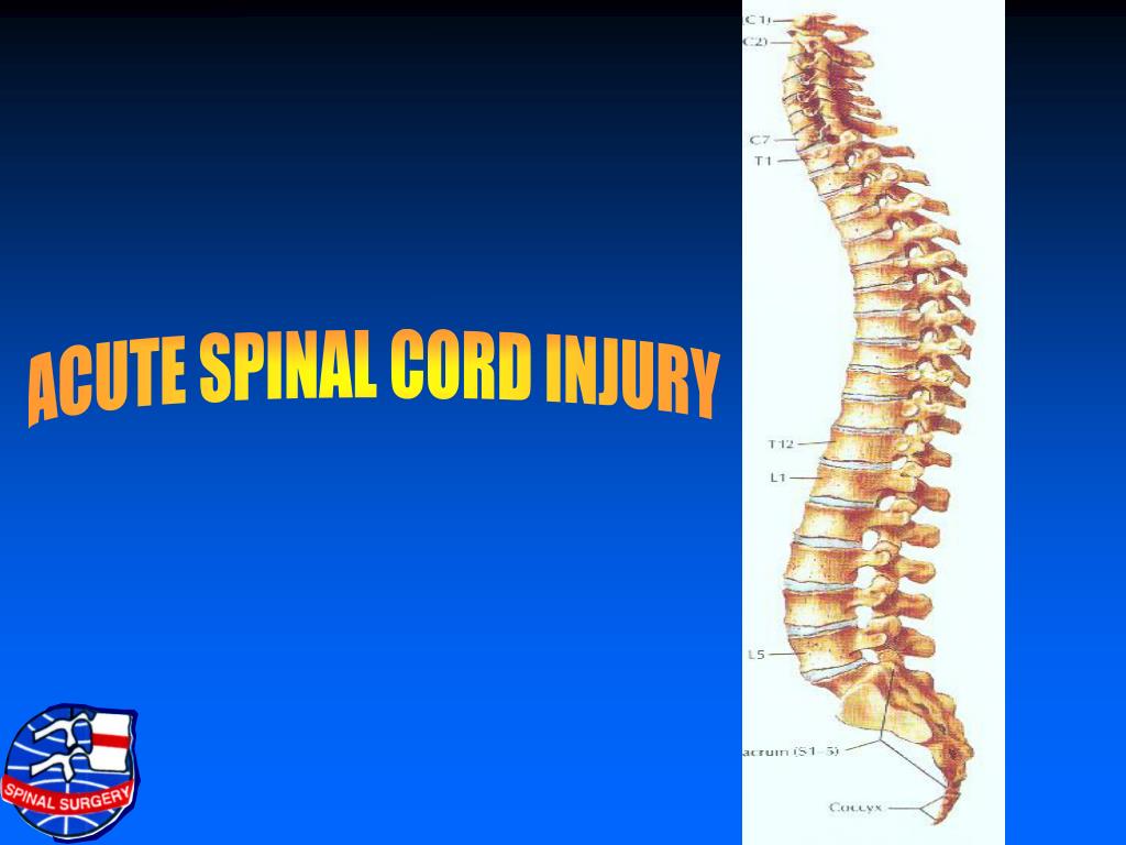 PPT - ACUTE SPINAL CORD INJURY PowerPoint Presentation, free download ...