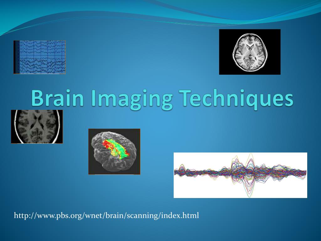 PPT - Brain Imaging Techniques PowerPoint Presentation, free download ...