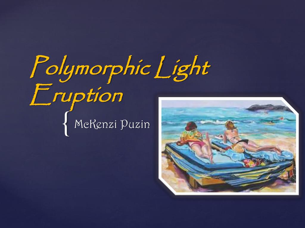 PPT - Polymorphic Light Eruption PowerPoint Presentation, free download ...