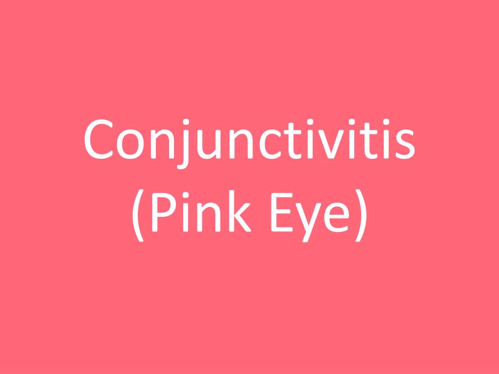 PPT - Conjunctivitis (Pink Eye) PowerPoint Presentation, free download ...