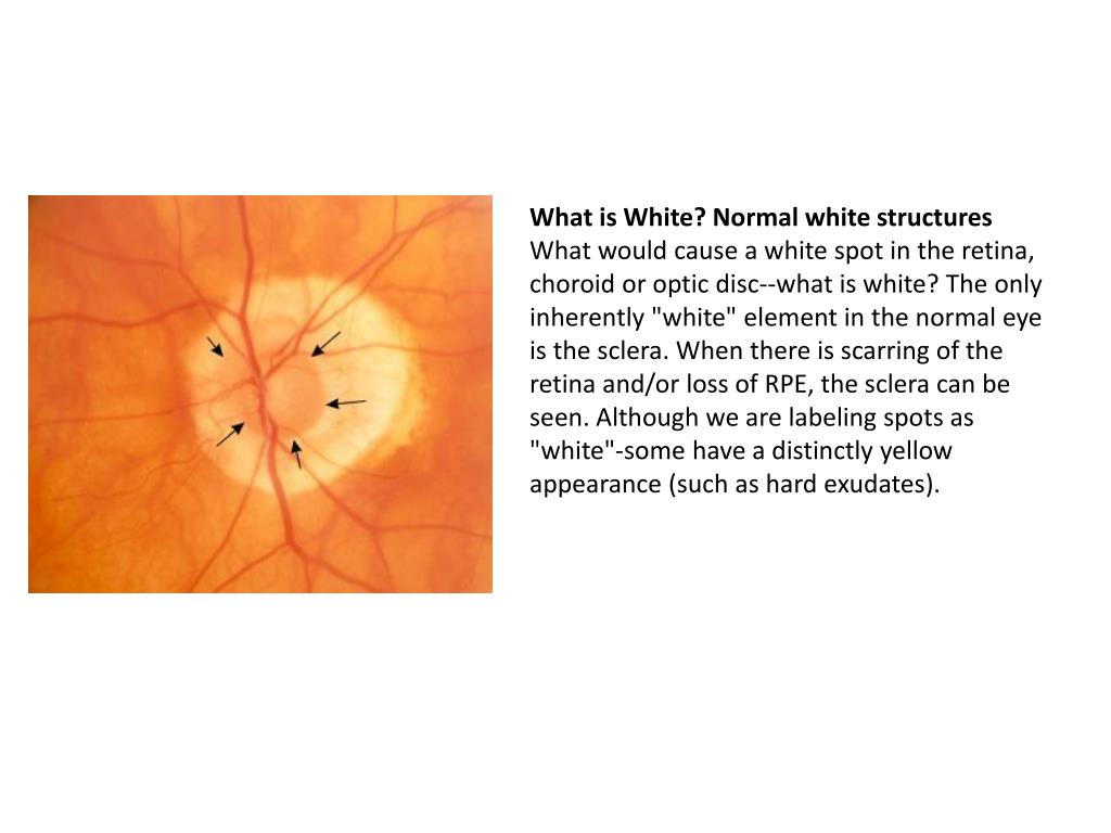 PPT - What is White? Normal white structures PowerPoint Presentation ...
