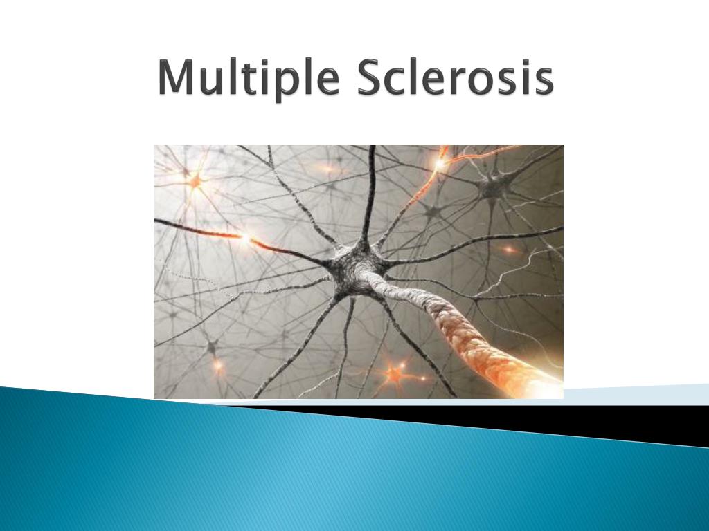PPT - Multiple Sclerosis PowerPoint Presentation, free download - ID ...