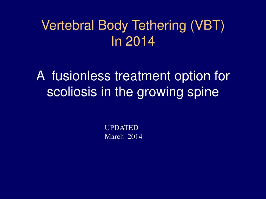 PPT - Vertebral Body Tethering (VBT) In 2014 PowerPoint Presentation ...