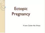 PPT - Ectopic Pregnancy PowerPoint Presentation, free download - ID:6916819