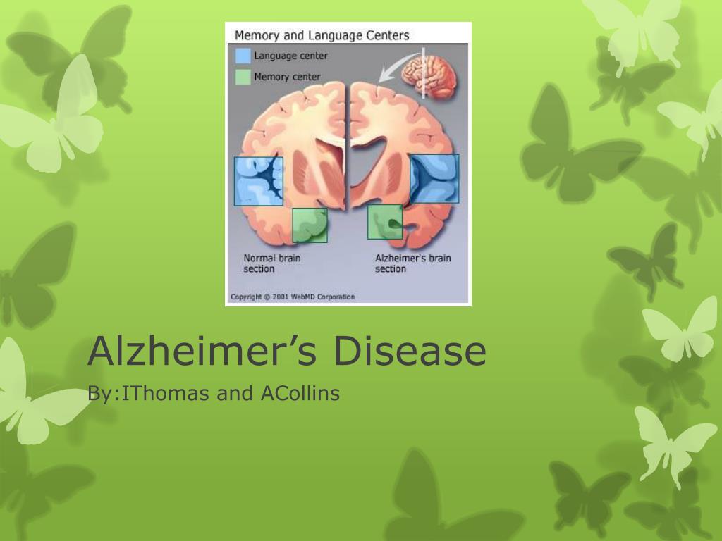 PPT - Alzheimer’s Disease PowerPoint Presentation, free download - ID ...