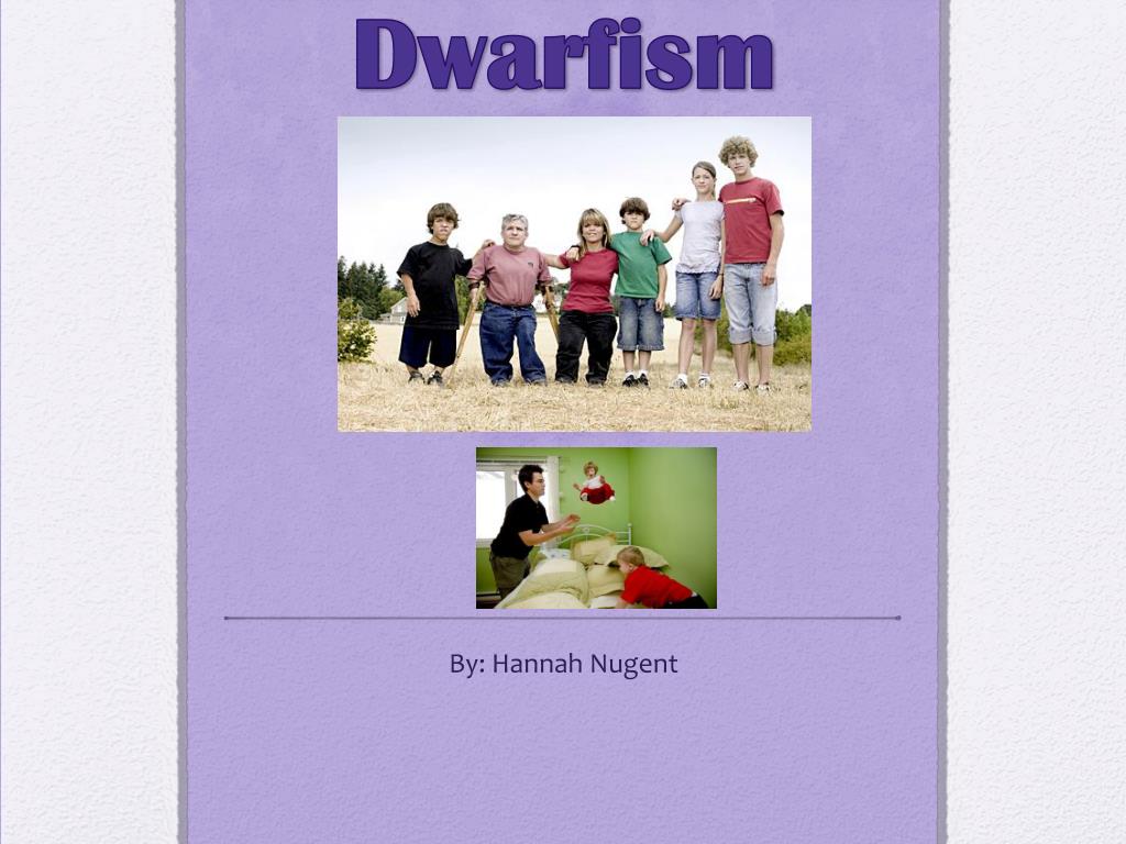 PPT - Dwarfism PowerPoint Presentation, free download - ID:1885711