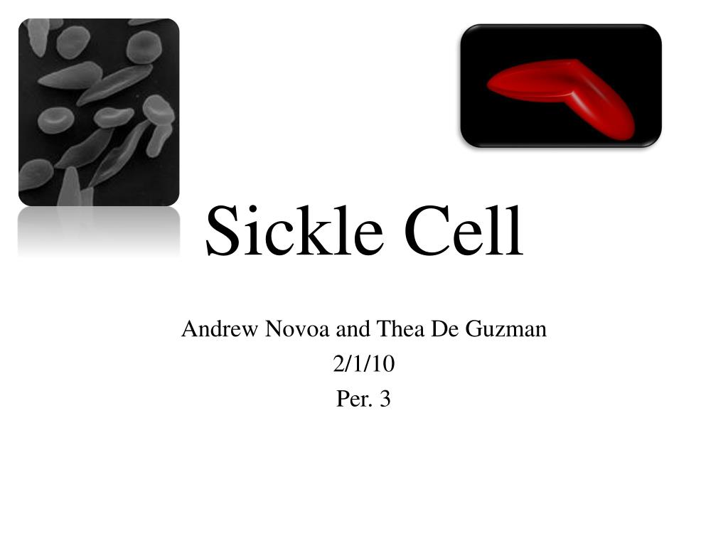PPT - Sickle Cell PowerPoint Presentation, free download - ID:1904924