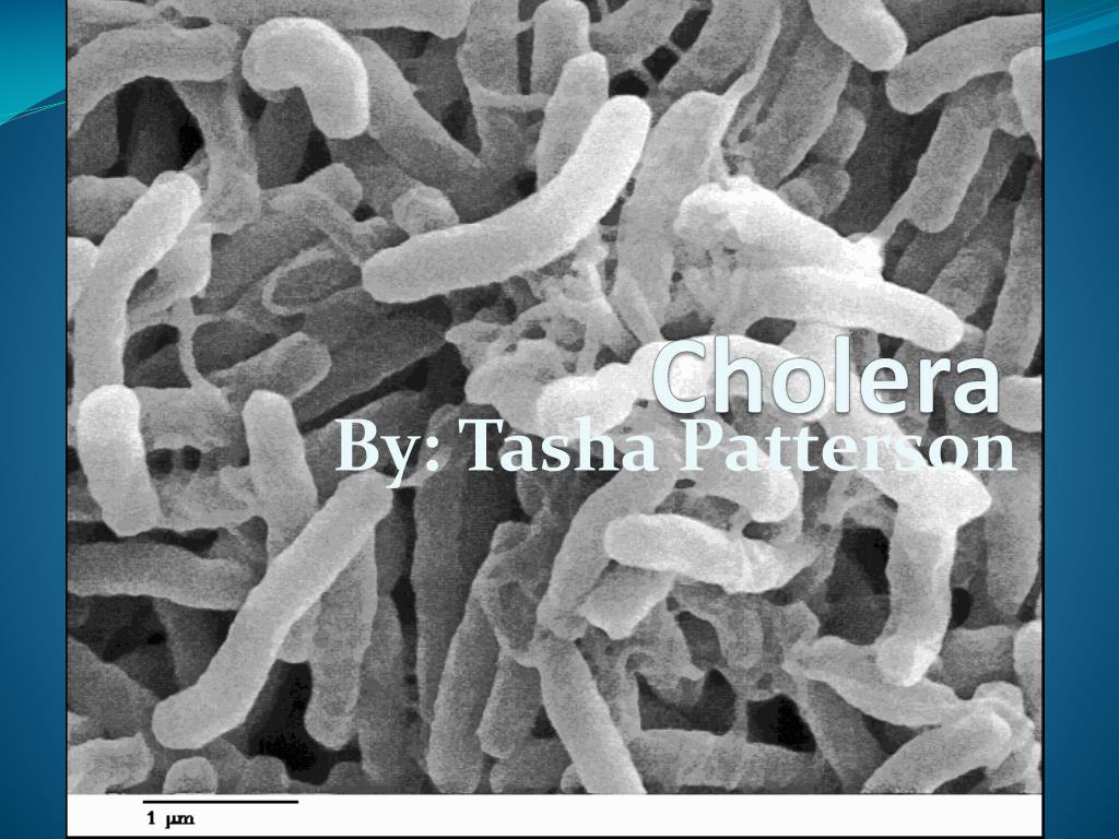 PPT - Cholera PowerPoint Presentation, free download - ID:1907157