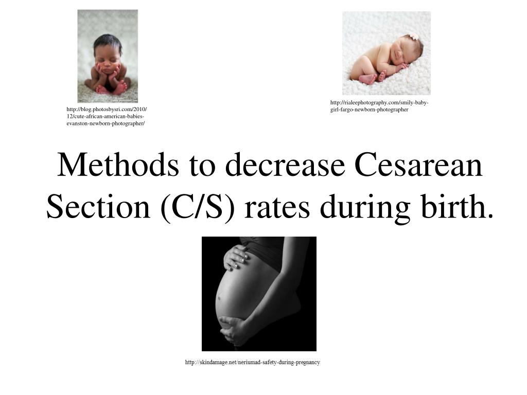 PPT - Methods to decrease Cesarean Section (C/S) rates during birth ...