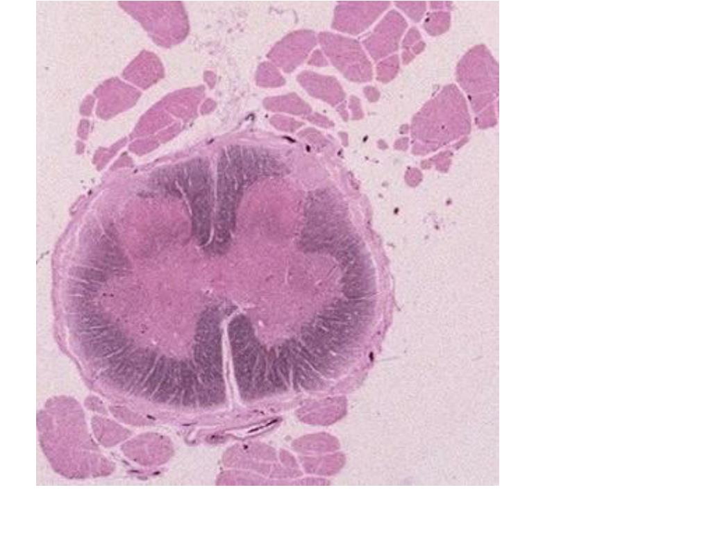 PPT - Sacral Cord PowerPoint Presentation, free download - ID:1916133
