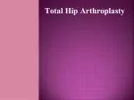 PPT - Hip Arthroplasty PowerPoint Presentation, free download - ID:745056