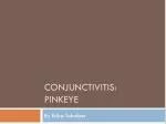 PPT - Conjunctivitis PowerPoint Presentation, free download - ID:4607614