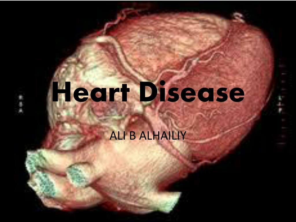PPT - Heart Disease PowerPoint Presentation, free download - ID:1935357