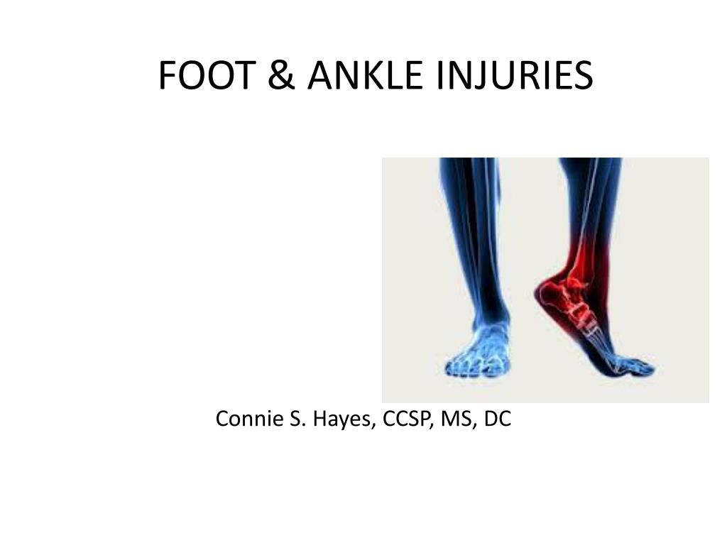 PPT - FOOT & ANKLE INJURIES PowerPoint Presentation, free download - ID ...