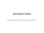 PPT - Ulcerative colitis PowerPoint Presentation, free download - ID ...