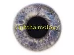 PPT - Biomaterials in Ophthalmology PowerPoint Presentation, free ...