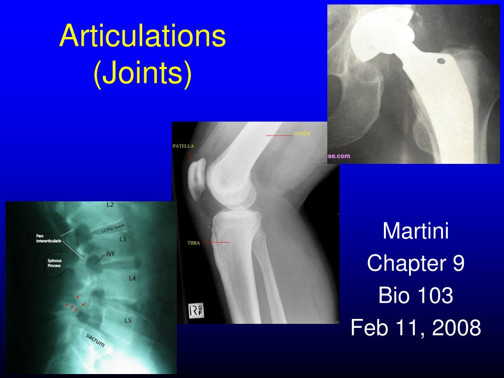 PPT - Articulations (Joints) PowerPoint Presentation, free download ...