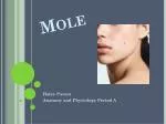 PPT - Vesicular Mole PowerPoint Presentation, free download - ID:9333531
