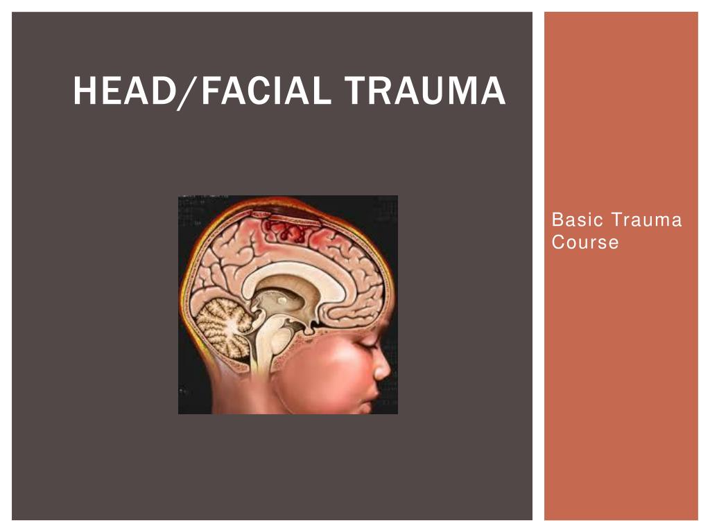 PPT - Head/Facial Trauma PowerPoint Presentation, free download - ID ...