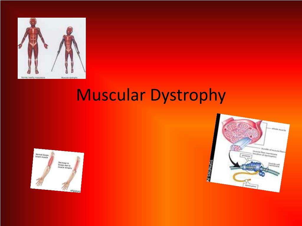 PPT - Muscular Dystrophy PowerPoint Presentation, free download - ID ...