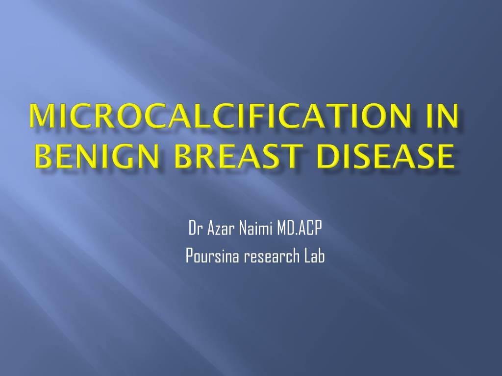 PPT - MICROCALCIFICATION IN BENIGN BREAST DISEASE PowerPoint ...