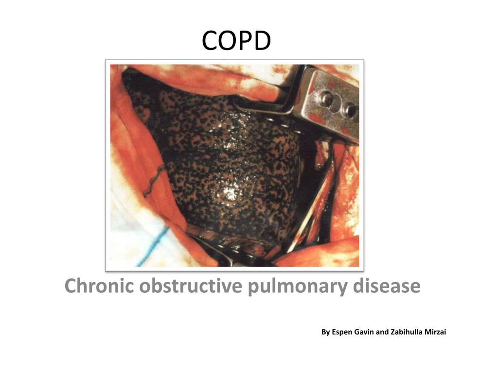PPT - COPD PowerPoint Presentation, free download - ID:2046992