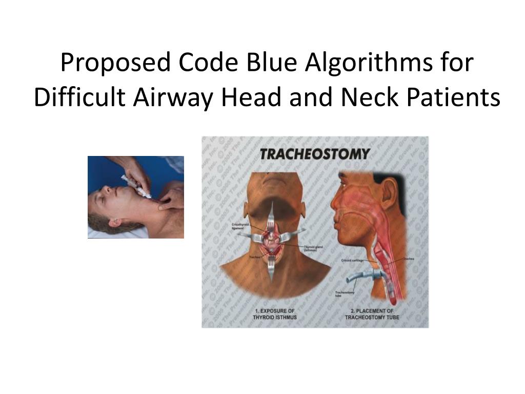 PPT - Proposed Code Blue Algorithms for Difficult Airway Head and Neck ...