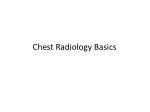 PPT - Chest Radiology Plain Film and CT- Beyond the Basics PowerPoint ...