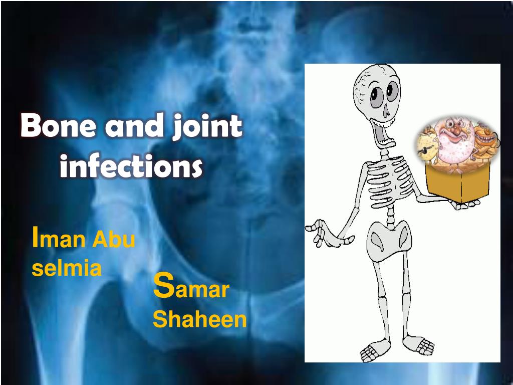 PPT - Bone and joint infections PowerPoint Presentation, free download ...