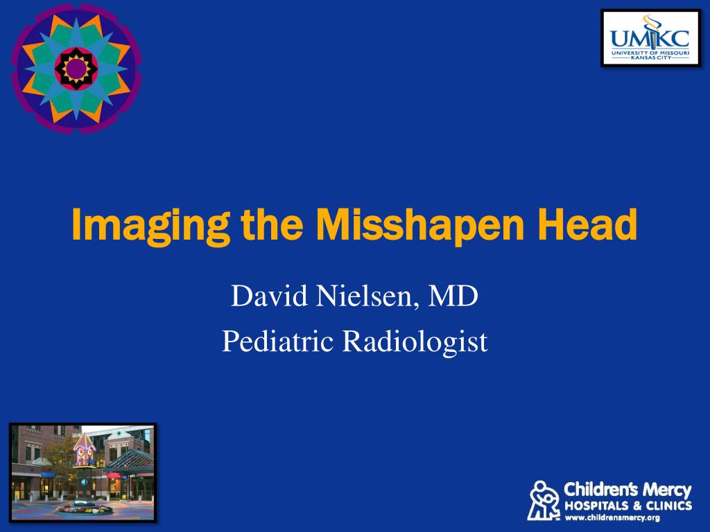 PPT - Imaging the Misshapen Head PowerPoint Presentation, free download ...