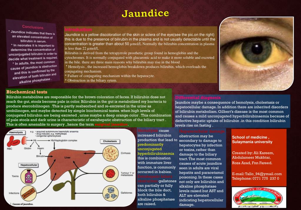 PPT - Jaundice PowerPoint Presentation, free download - ID:2084636