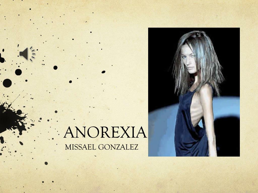 PPT - ANOREXIA PowerPoint Presentation, free download - ID:2097562