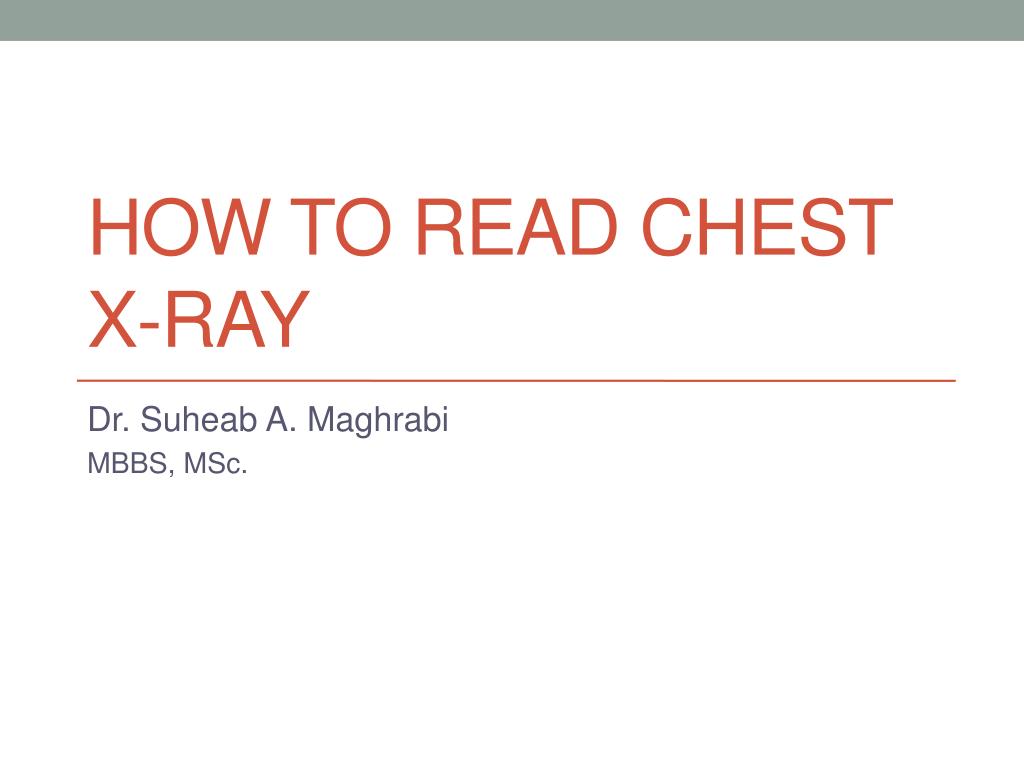PPT - How to read chest x-ray PowerPoint Presentation, free download ...
