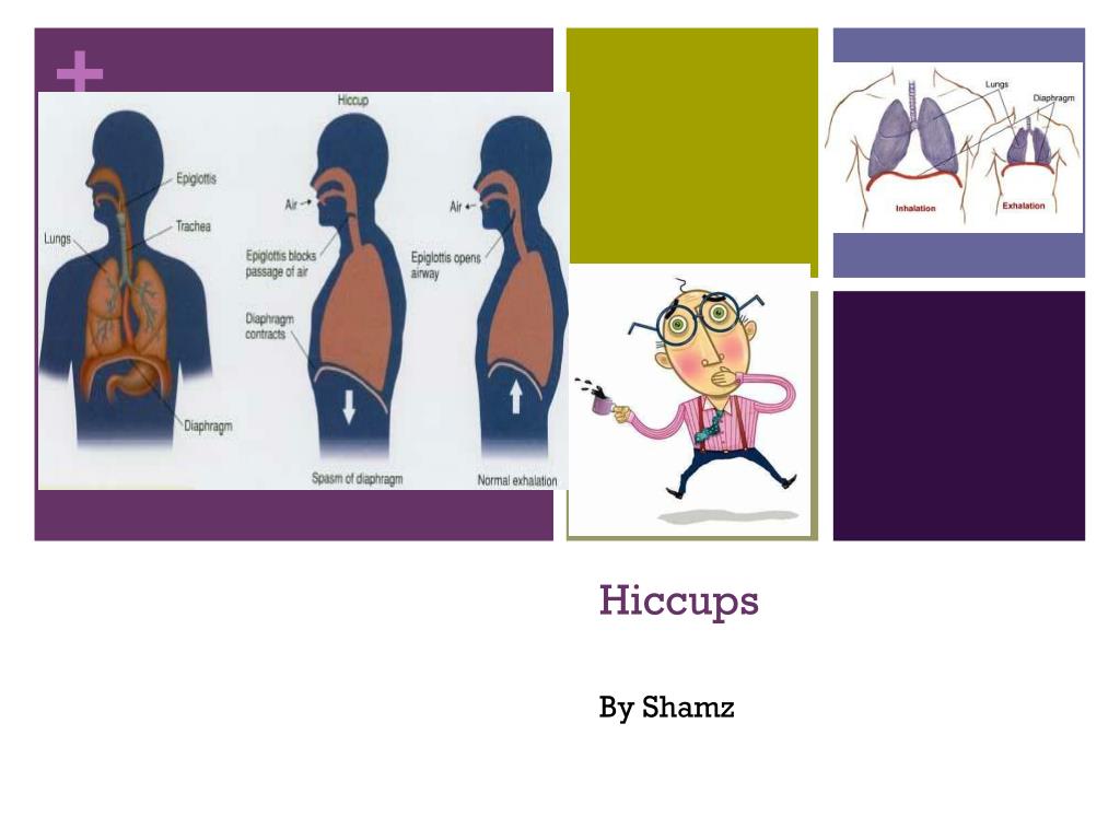 PPT - Hiccups PowerPoint Presentation, free download - ID:2119885