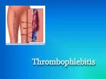 PPT - Thrombophlebitis (DVT) 842 PowerPoint Presentation, free download ...
