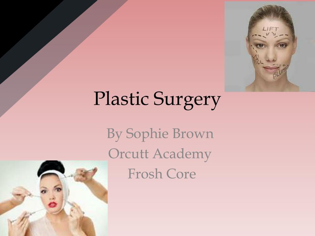 PPT - Plastic Surgery PowerPoint Presentation, free download - ID:2157834
