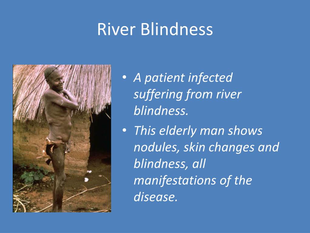 PPT - River Blindness PowerPoint Presentation, free download - ID:2175765
