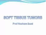 PPT - Soft tissue sarcomas PowerPoint Presentation, free download - ID ...