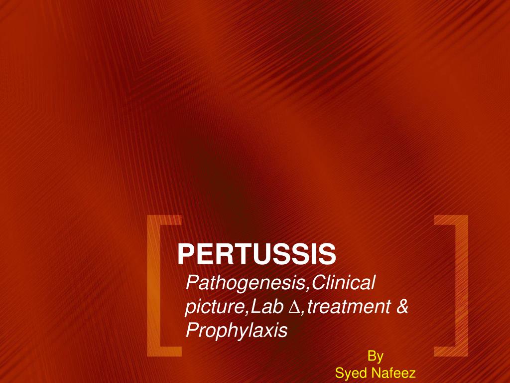 PPT - PERTUSSIS PowerPoint Presentation, free download - ID:2181676
