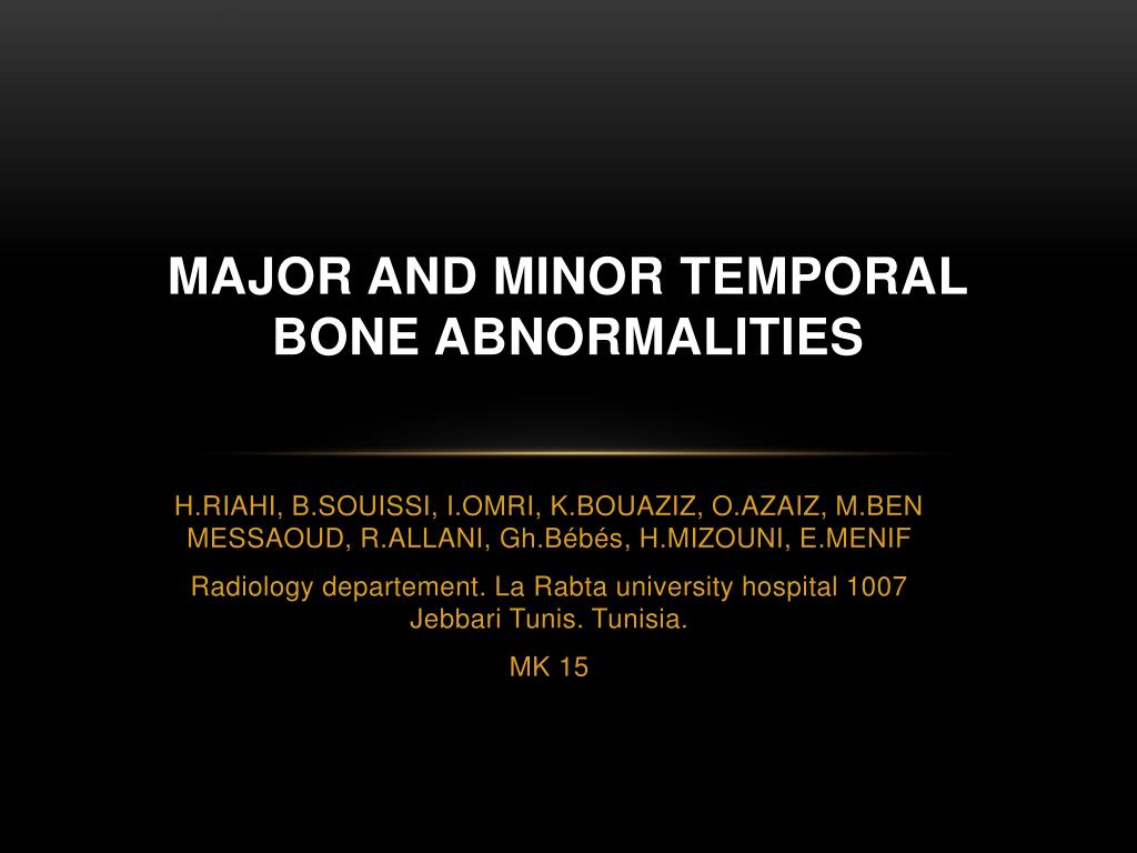 PPT - MAJOR AND MINOR TEMPORAL BONE ABNORMALITIES PowerPoint ...