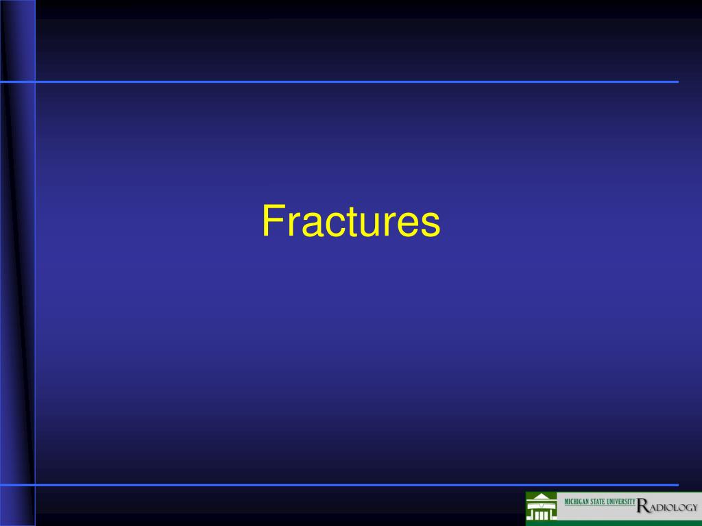 PPT - Fractures PowerPoint Presentation, free download - ID:2188482