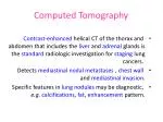 PPT - Computed Radiography PowerPoint Presentation, free download - ID ...