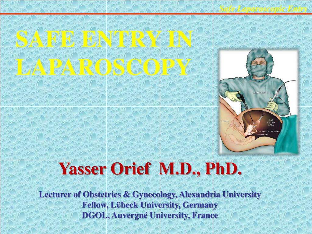 PPT - SAFE ENTRY IN LAPAROSCOPY PowerPoint Presentation, free download ...