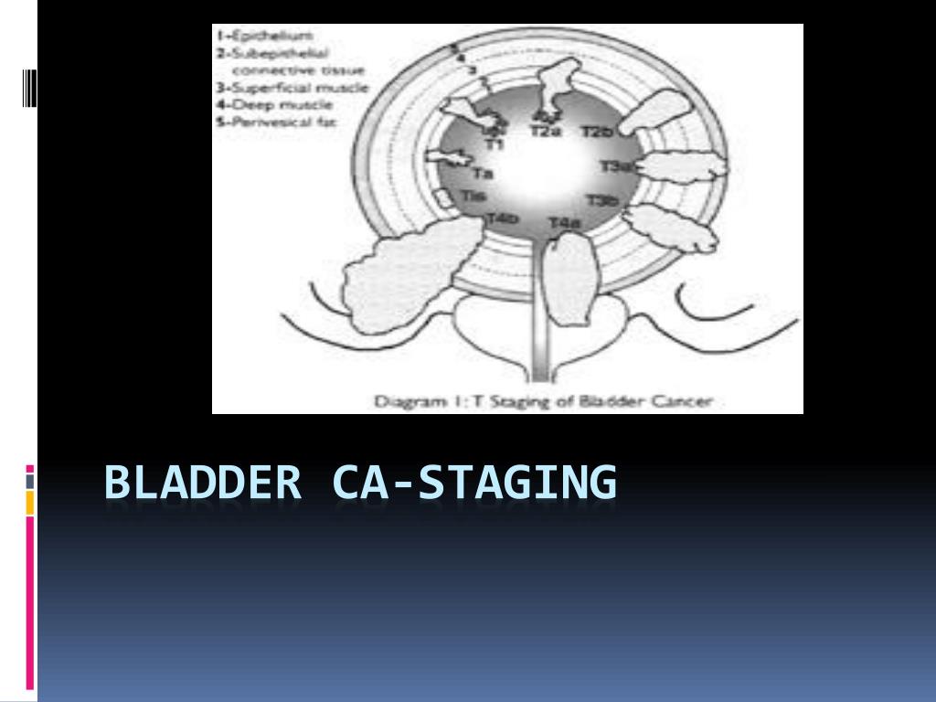 PPT - Bladder CA-Staging PowerPoint Presentation, free download - ID ...